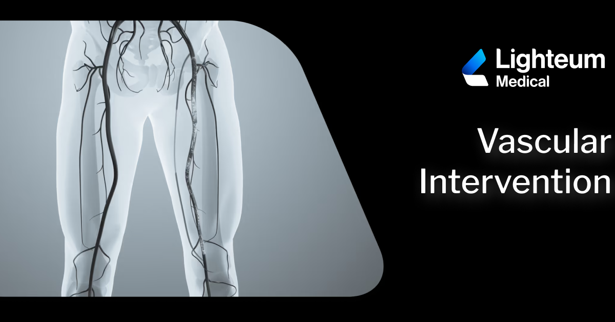 Vascular Intervention Components | Lighteum Medical